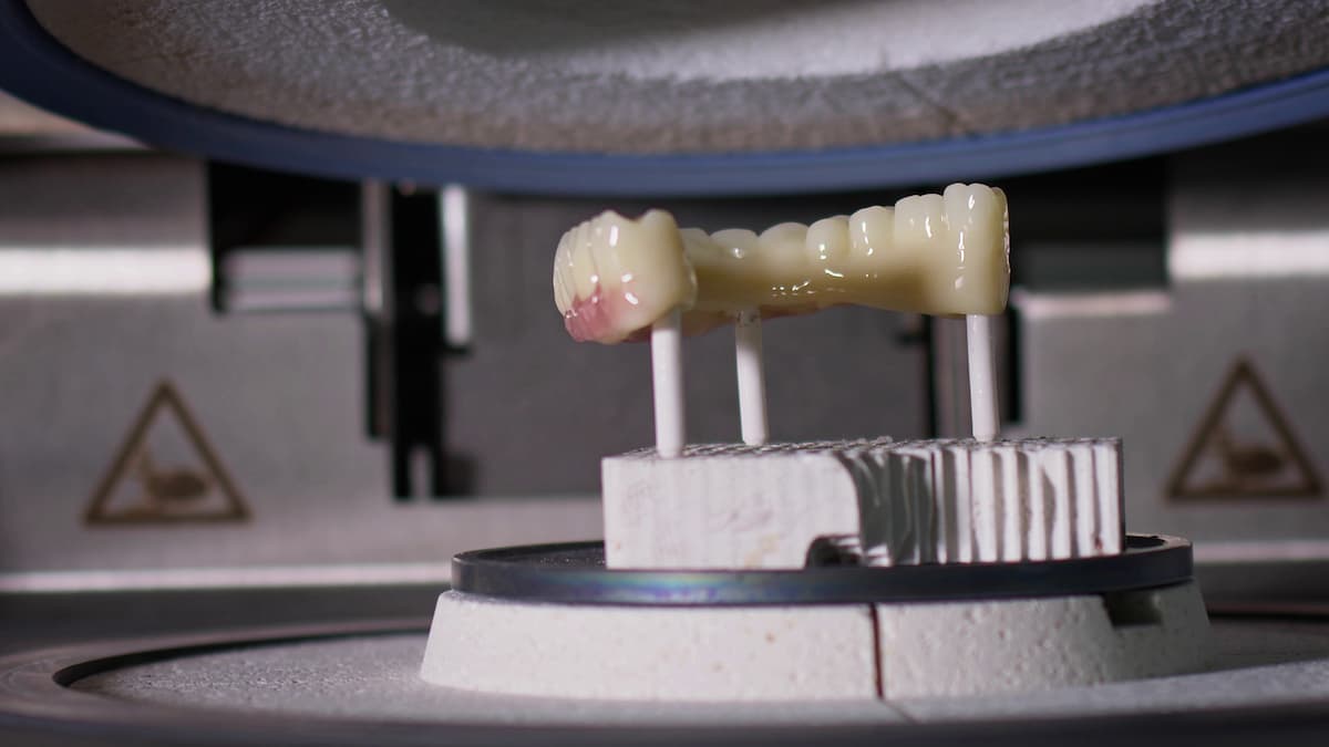 What Is a Partial Denture? Everything You Need to Know | True Dentistry Plus